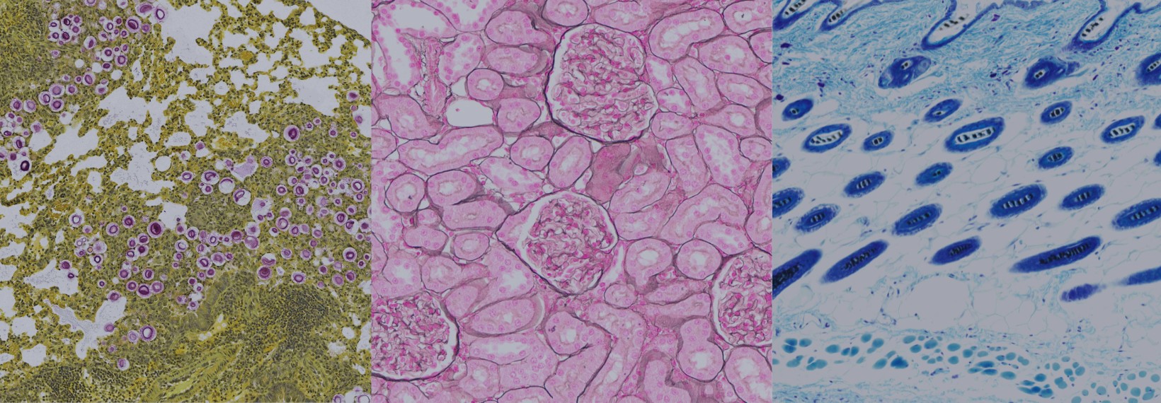 Special Stain | Wax-it Histology Services Inc.